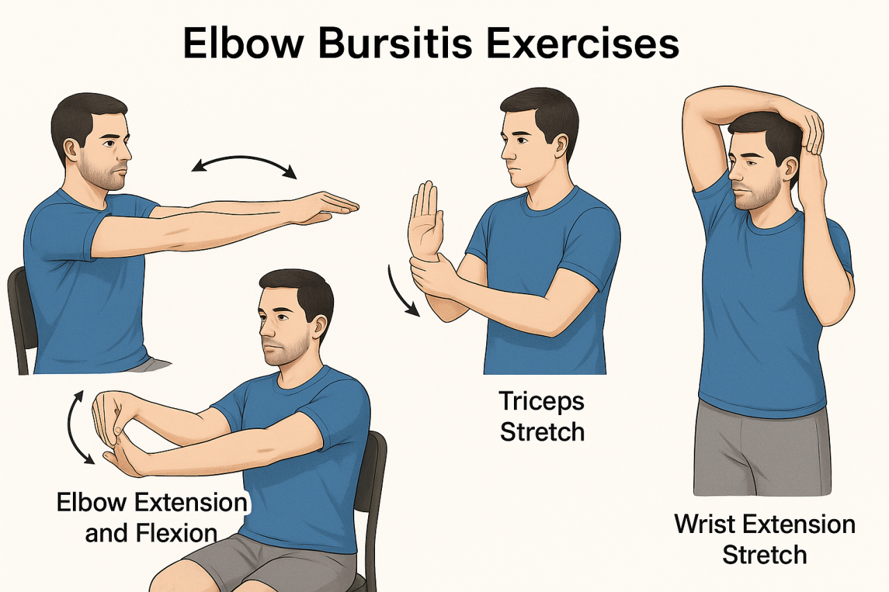 Tratamiento para la Bursitis del Codo - Training and Treatment